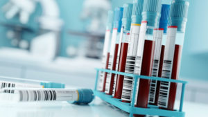 The Novel IsoPSA Test Significantly Reduces Unnecessary Biopsies While ...