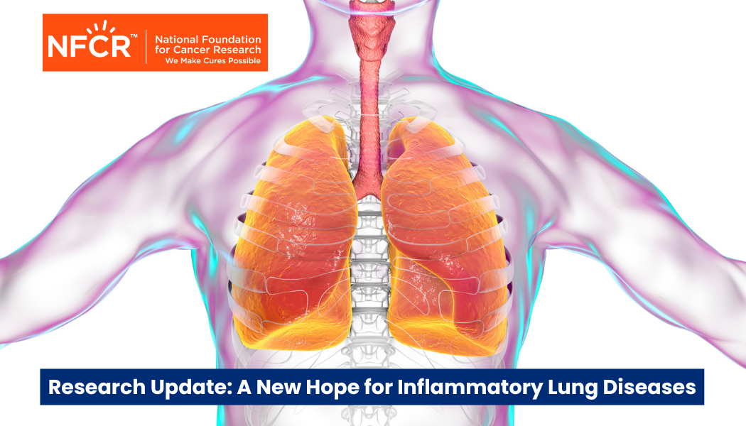 Research Update: A New Hope for Inflammatory Lung Diseases - NFCR